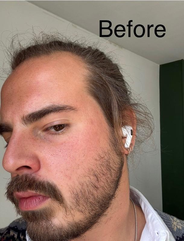 Red Light Mask | Rejuvenating LED Light Therapy | Qure