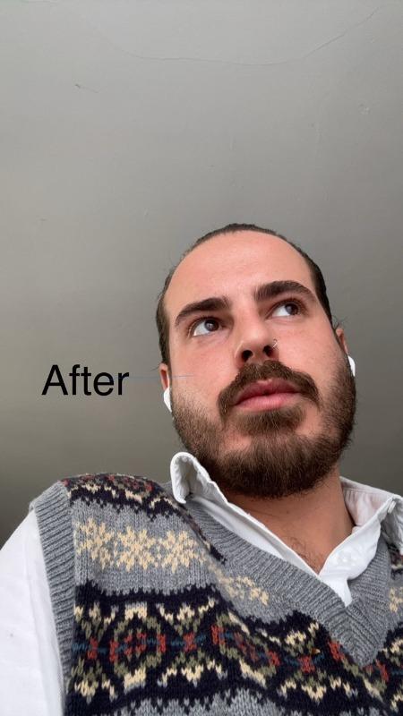 Red Light Mask | Rejuvenating LED Light Therapy | Qure