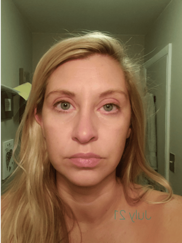 Oil Me Up - Oil Lovers Bundle – Dermay