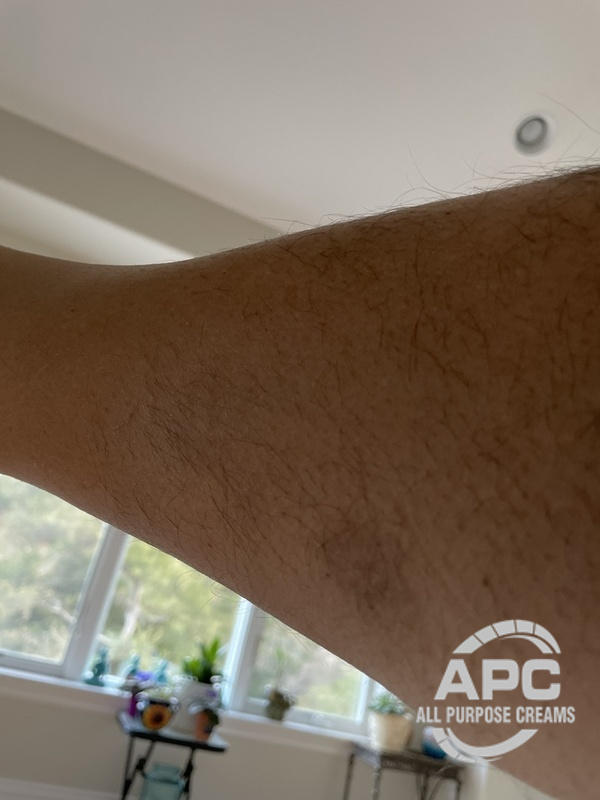 All Purpose Hydroquinone - Since 2017 – All Purpose Creams