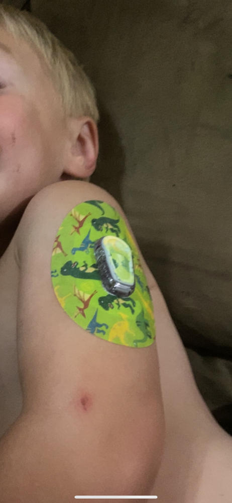 Pink Gingham Dexcom G6 Transmitter Sticker - ExpressionMed