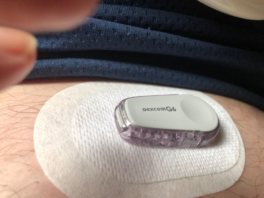 White Dexcom G6 UnderPatch - ExpressionMed