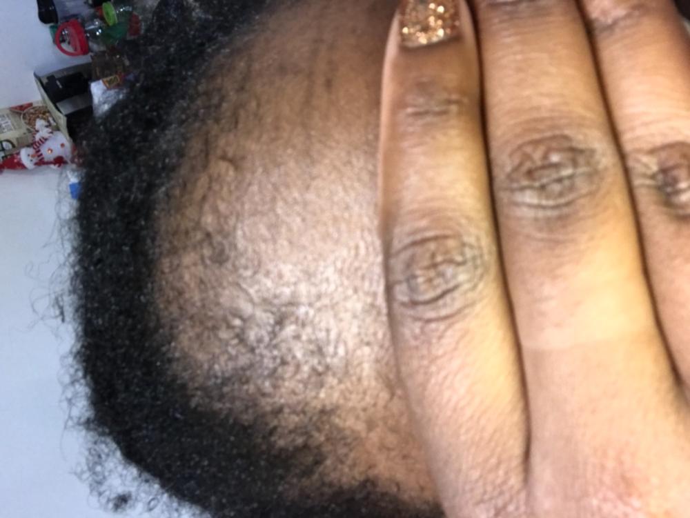 Renewing Hair Elixir – Renewed Hair Co