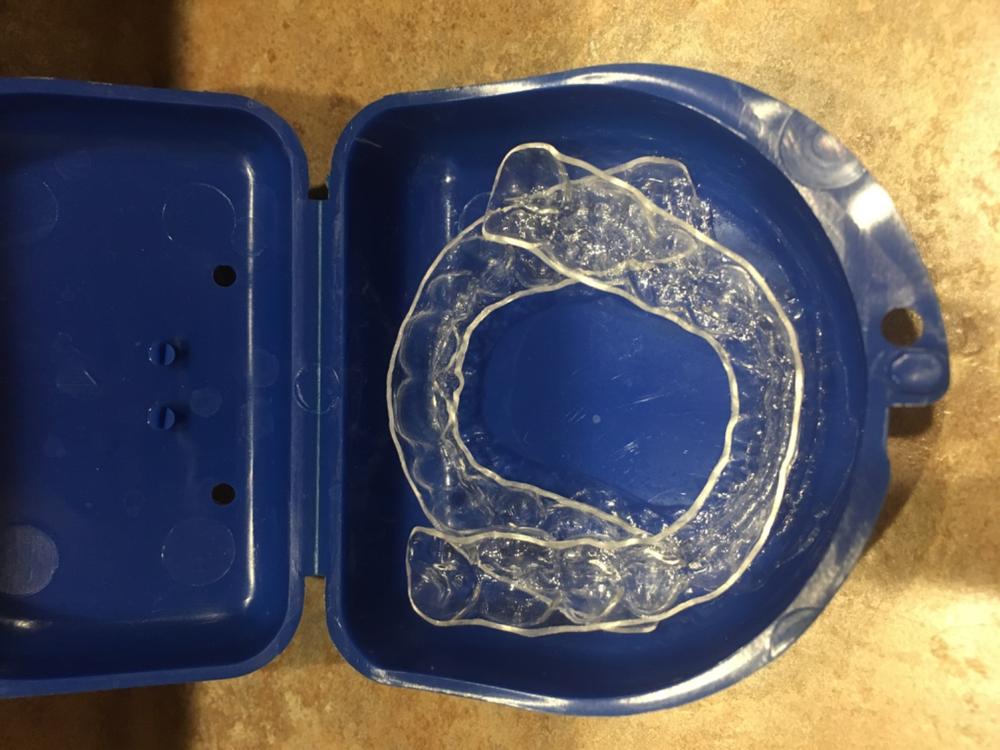 Custom Clear Upper and Lower Retainer Set - ClearRetain™