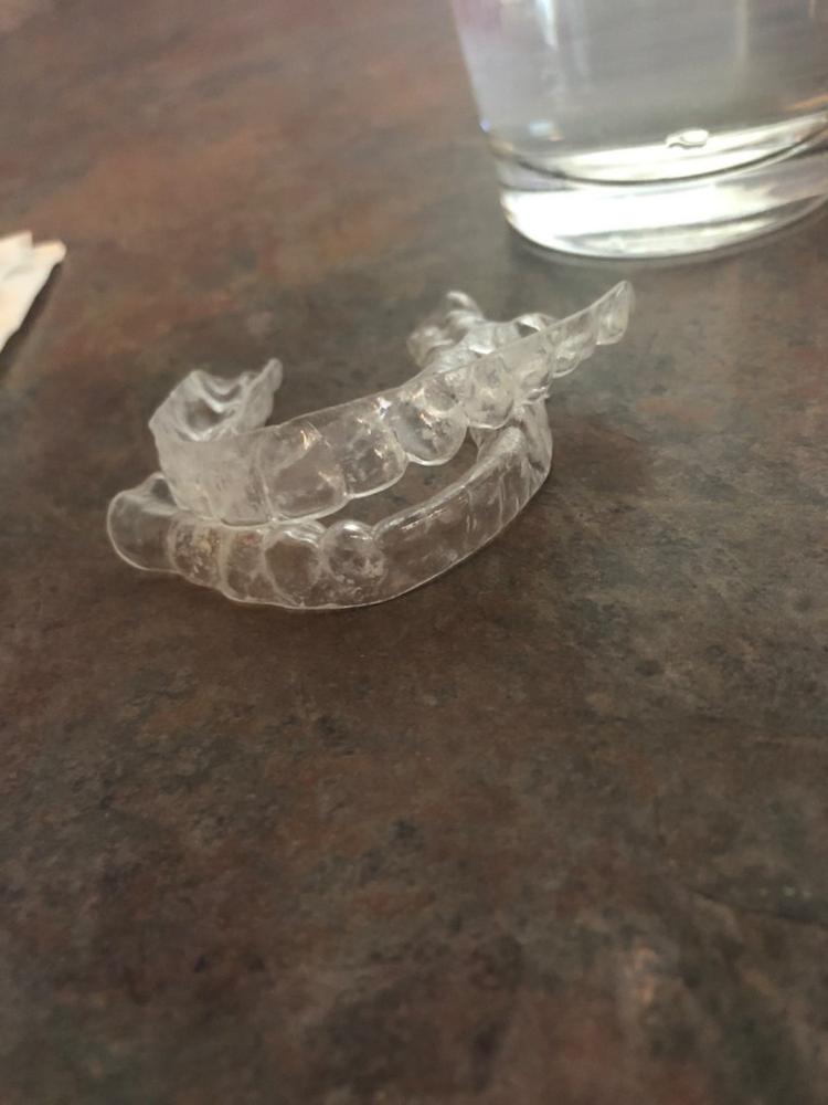 Custom Clear Upper and Lower Retainer Set - ClearRetain™
